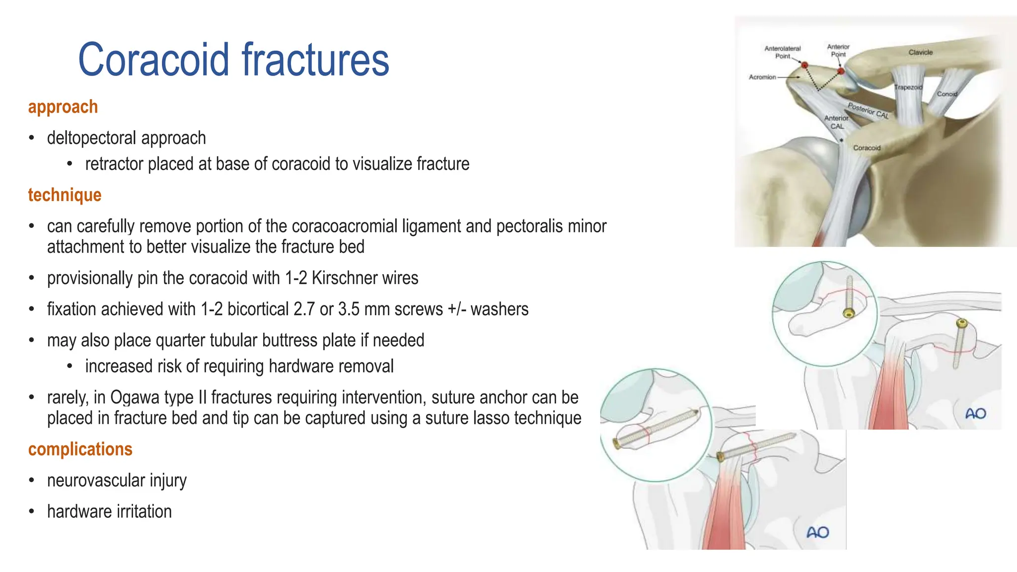 A review of Scapula Fractures with it's managment.pptx