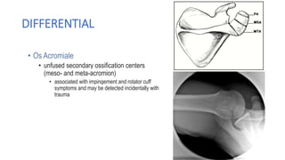 A review of Scapula Fractures with it's managment.pptx