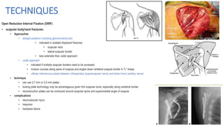 A review of Scapula Fractures with it's managment.pptx