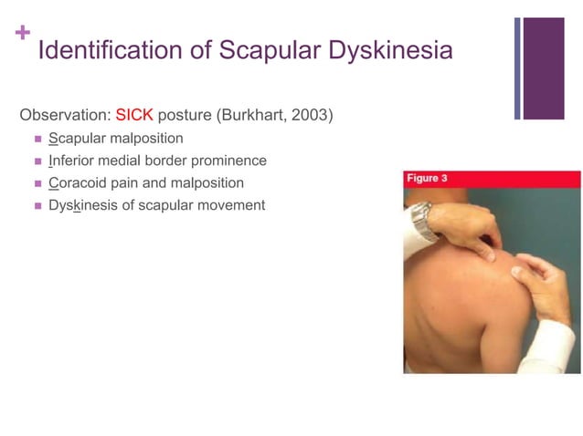 Scapular dyskinesia and its relationship to rotator cuff impingement ...