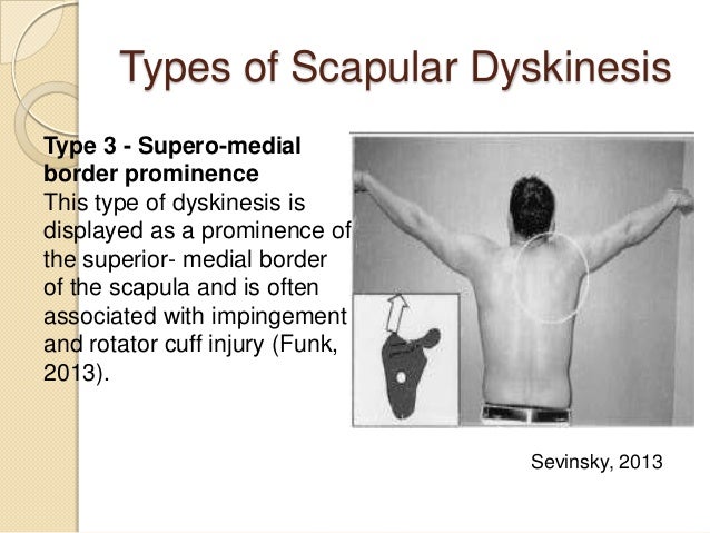 Scapular dyskinesis