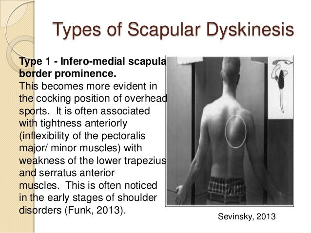 Scapular dyskinesis