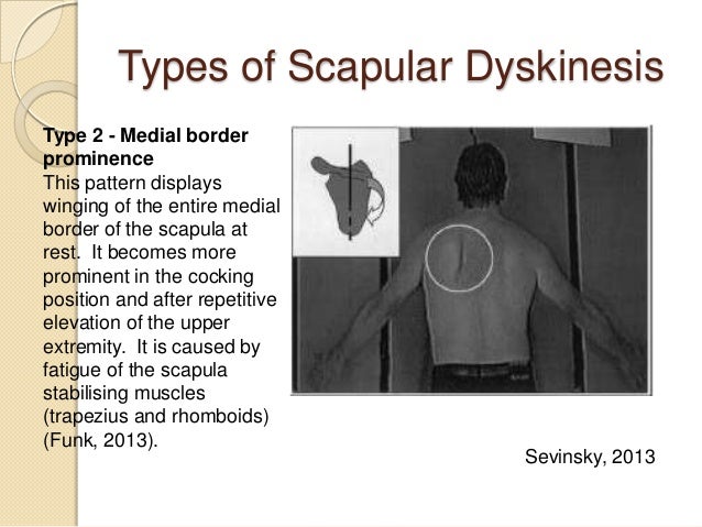Scapular dyskinesis