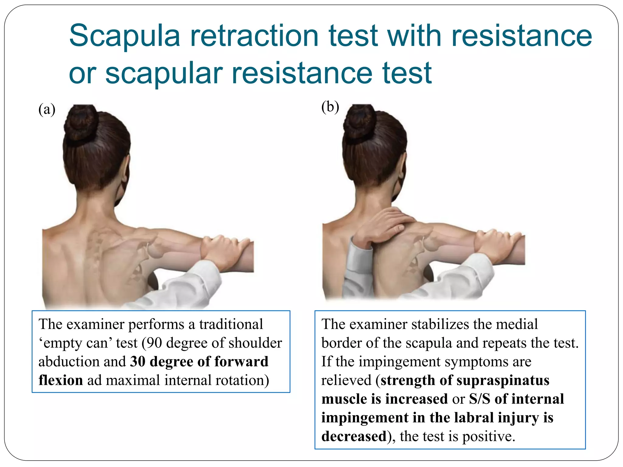 Scapular dyskinesis | PPTX