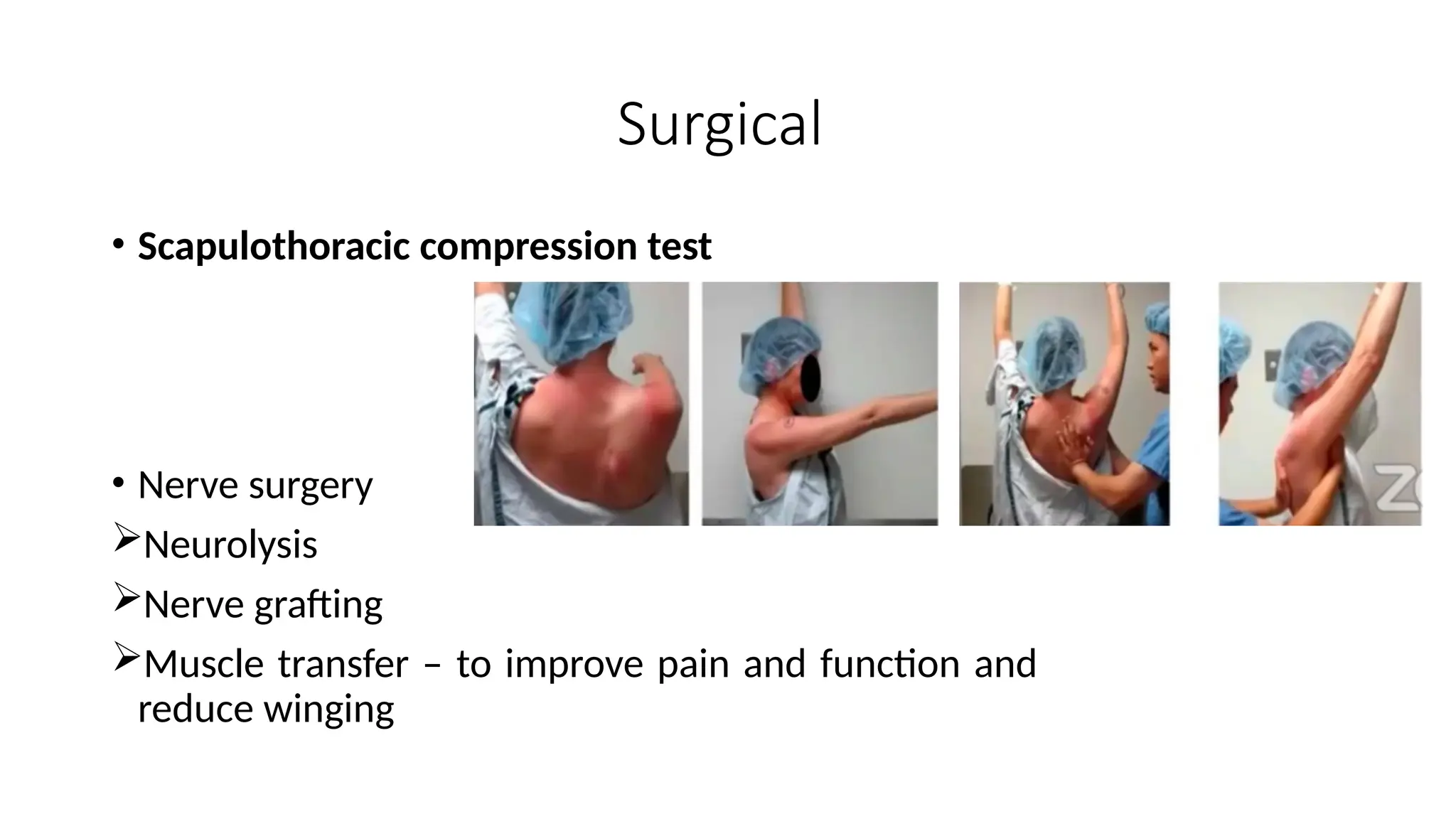 SCAPULAR DYSKINESIS types and management.pptx