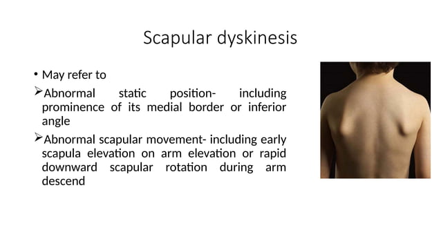 SCAPULAR DYSKINESIS types and management.pptx
