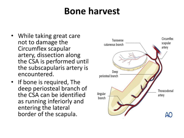 Scapular flap | PPT