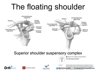 Scapular fractures | PPTX