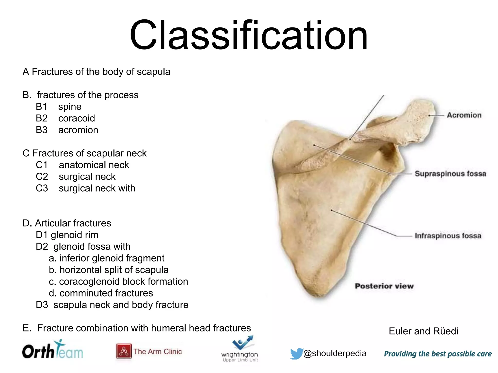 Scapular fractures | PPTX