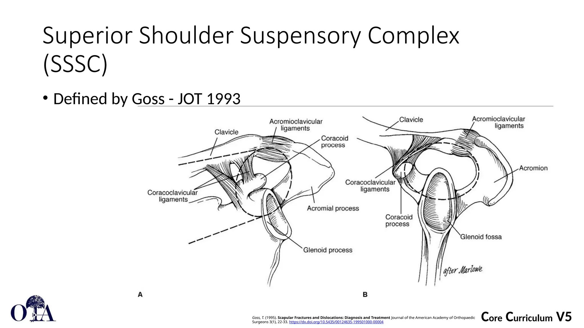 Scapular FracturesDJKLKLKLAJJFJJJJJJJJJJ | PPTX
