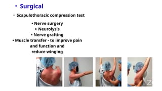 Scapular Instability in a mature skeleton | PPTX