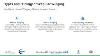 Scapular Winging Powerpoint presentation | PPTX