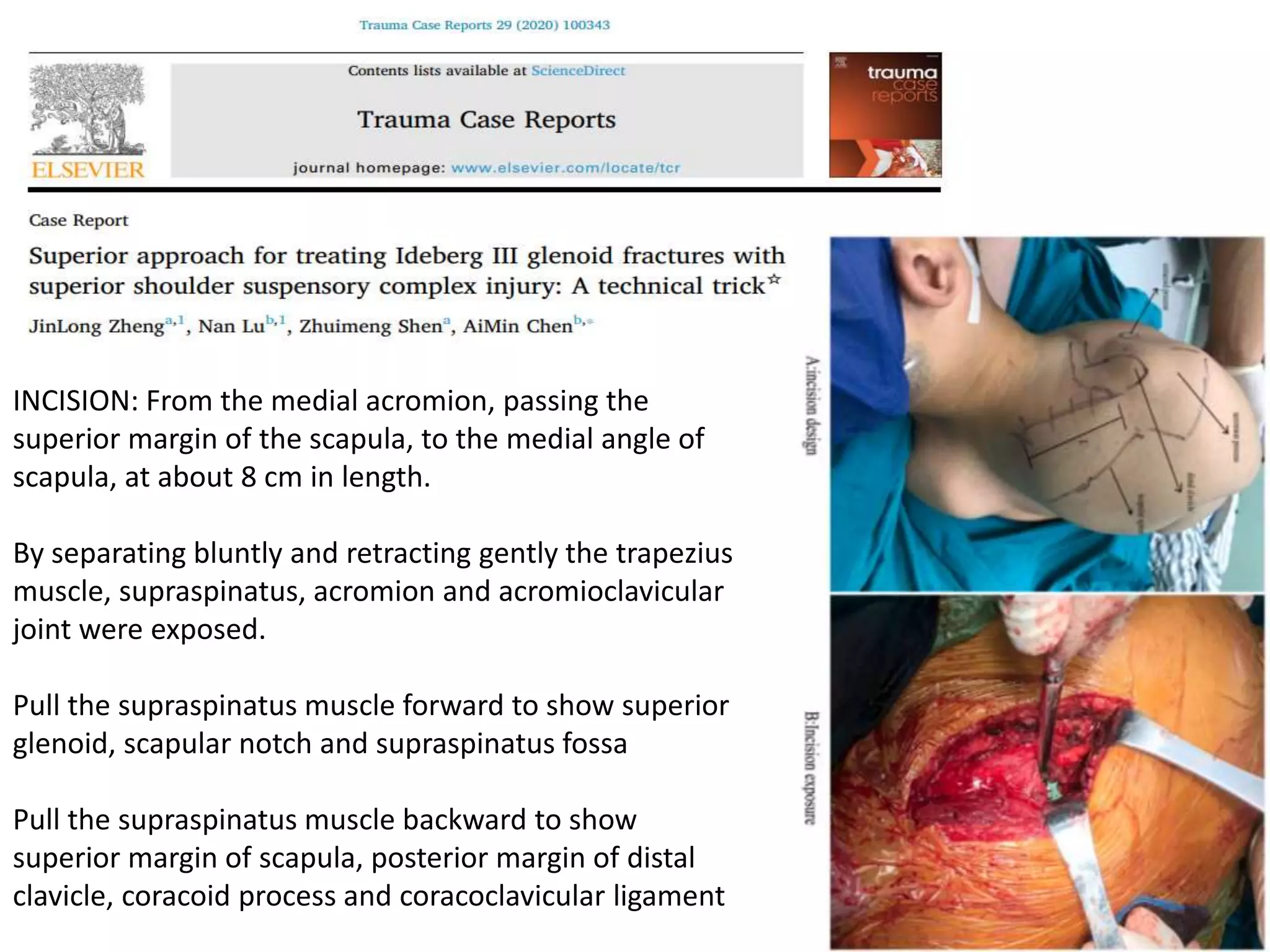 Scapula surgical approaches ppt | PPTX