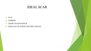 Scar | PPTX