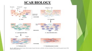 Scar | PPTX