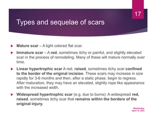 scar.ppt
