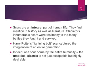 scar.ppt