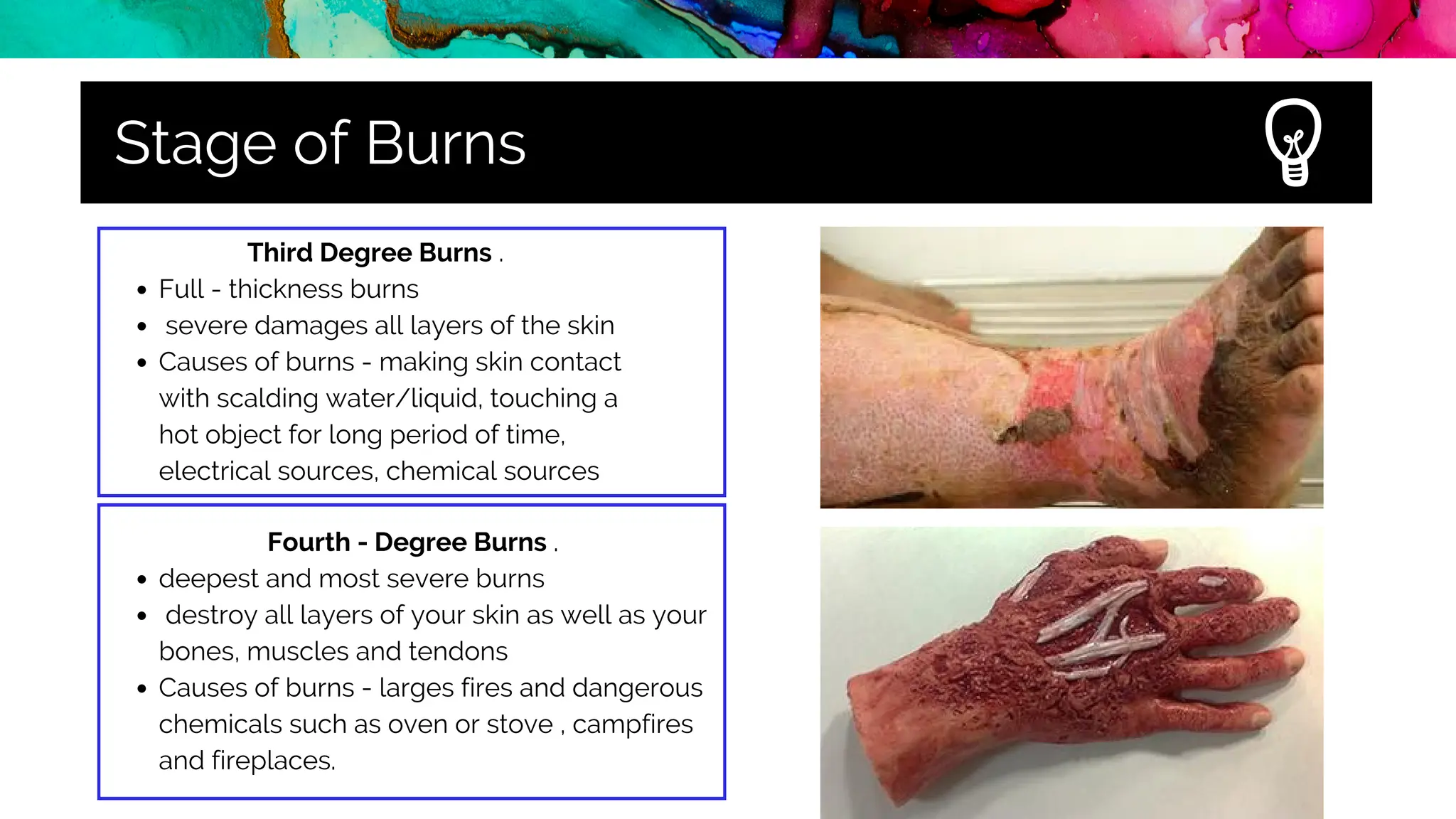 Burn and Scar management in occupational therapy | PDF