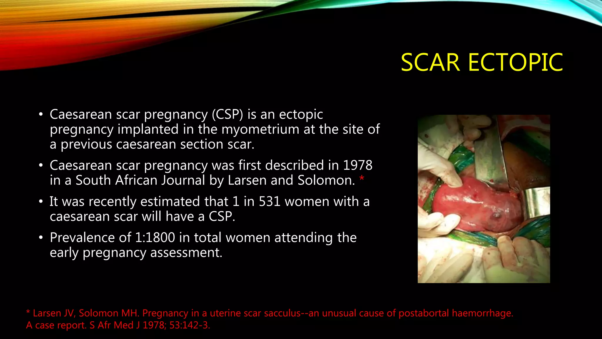 SCAR ECTOPIC | PPTX