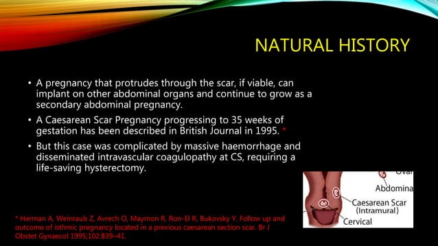 SCAR ECTOPIC | PPTX | Pregnancy | Reproductive Health