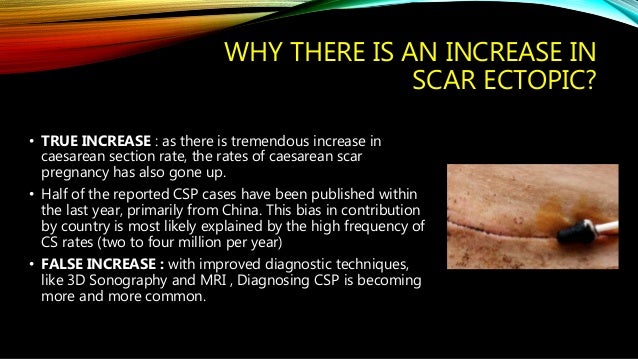 SCAR ECTOPIC