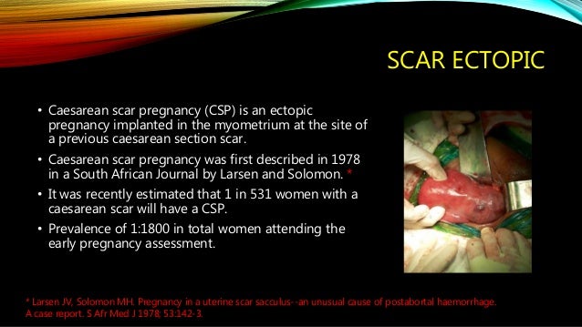 SCAR ECTOPIC