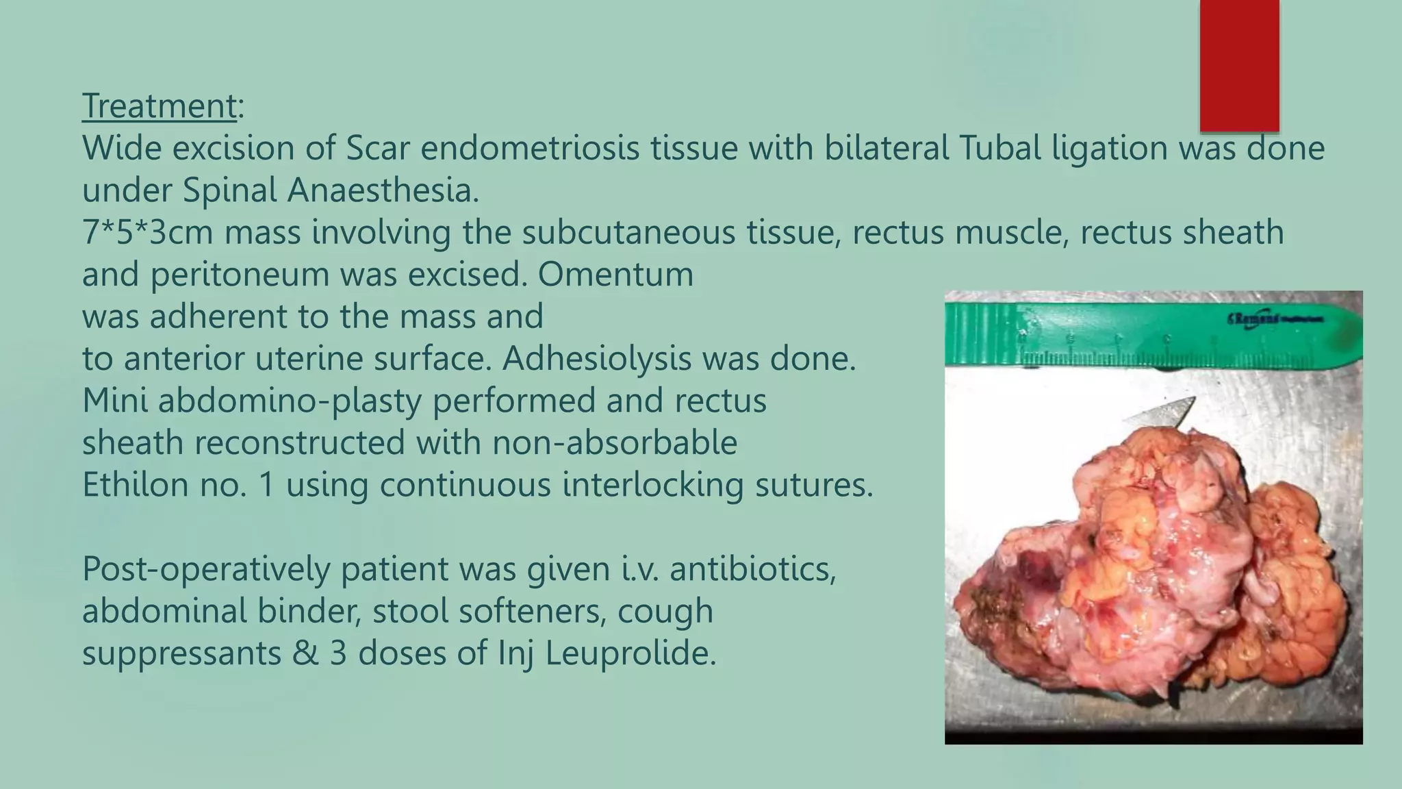 Case presentation on scar endometriosis | PPTX