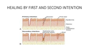 SCAR FORMATION AND TISSUE REPAIR notes.pptx