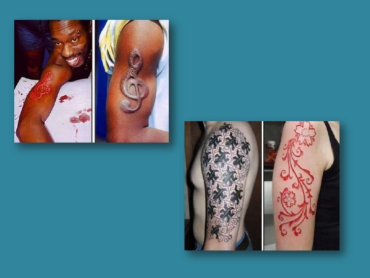 Scarification