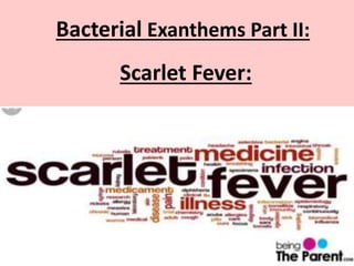 Scarlet Fever Made Very Simple and Easy | PPTX