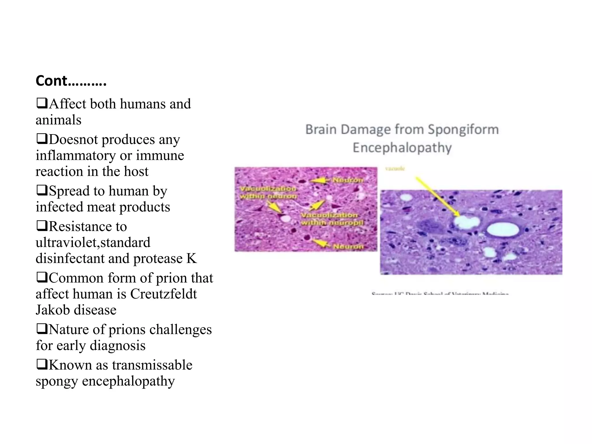 Prion disease | PPTX
