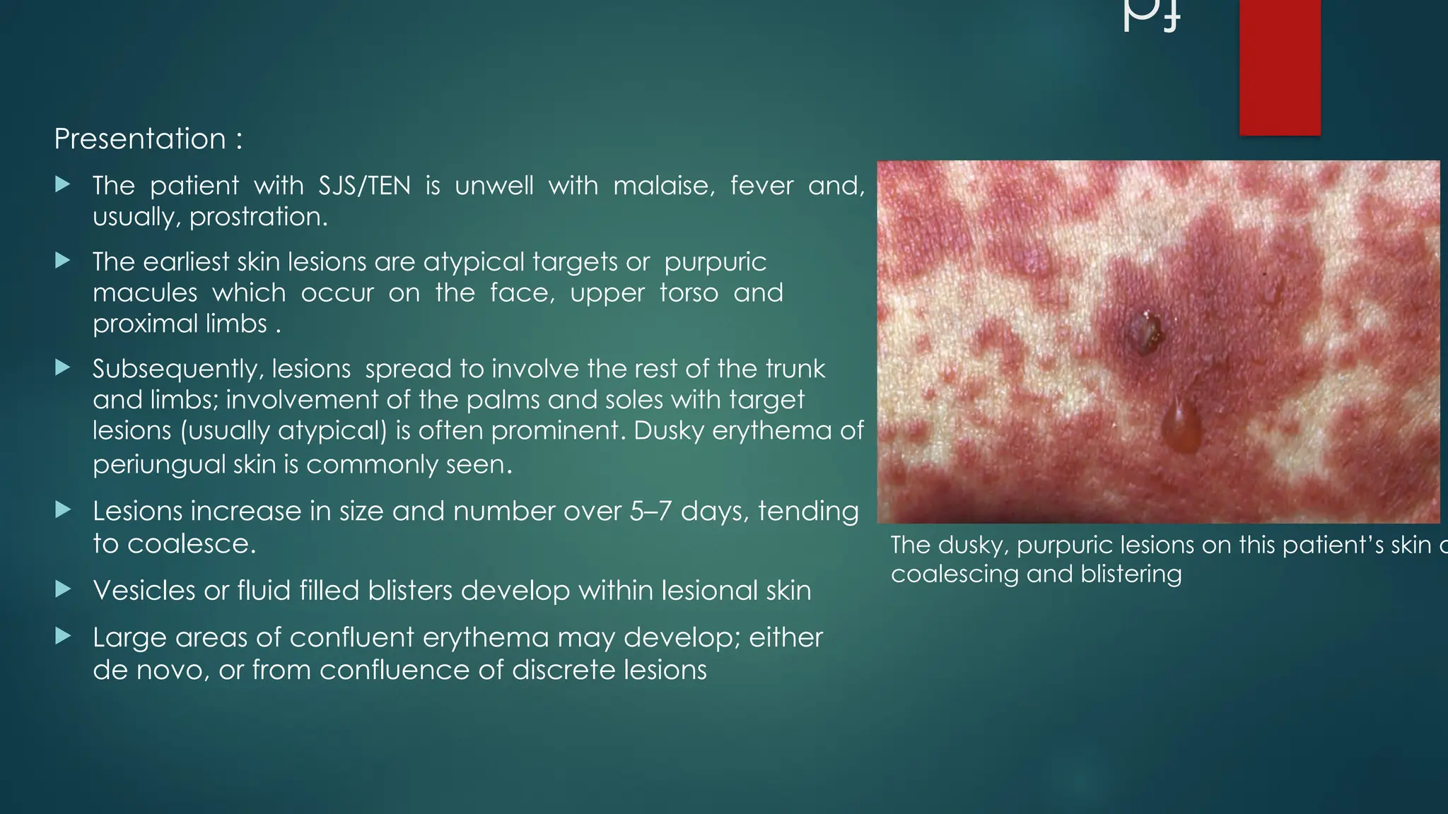 severe cutaneous adverse drug reactions . | PPTX