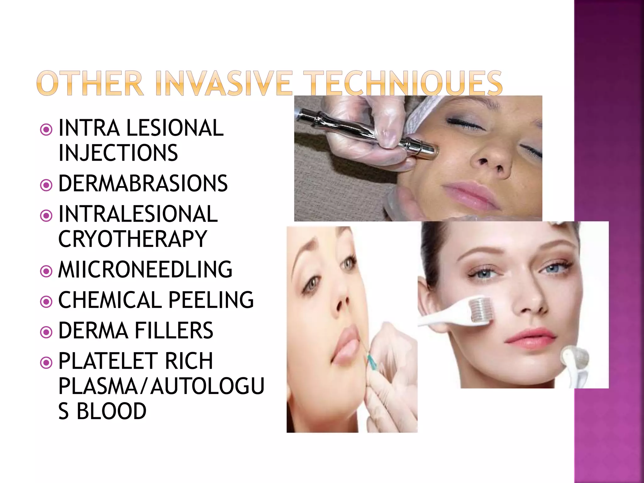 Scar revision | PPTX