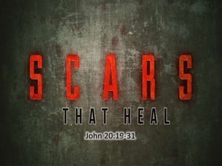 Scars.pptx