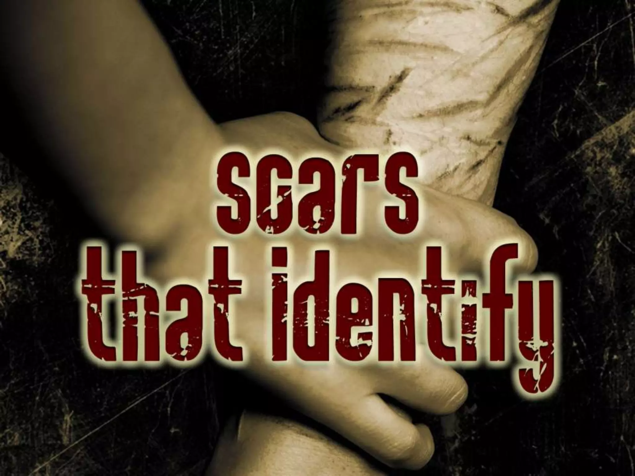 Scars identify | PPTX