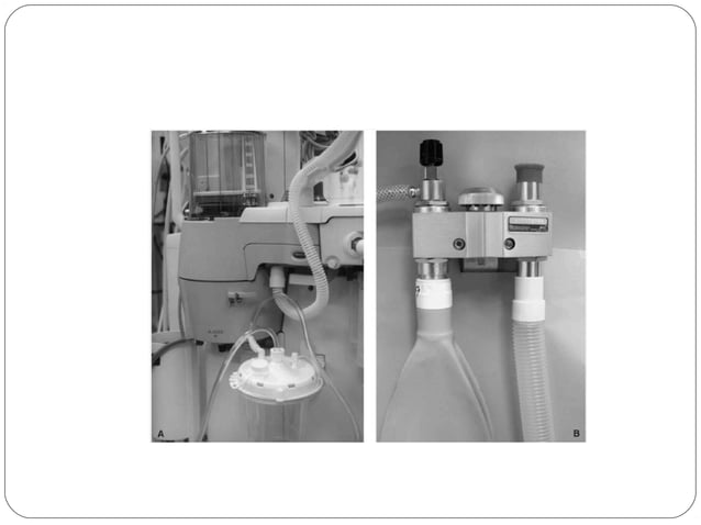 Scavenging system in operating room | PPT | First Aid | Injuries