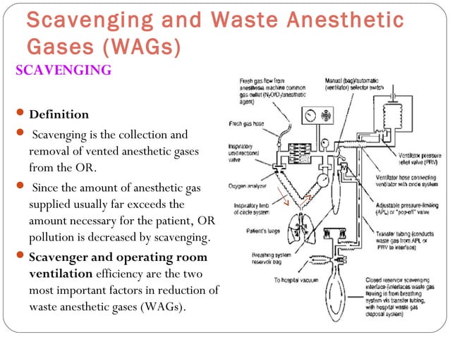 Scavenging system in operating room | PPT | First Aid | Injuries