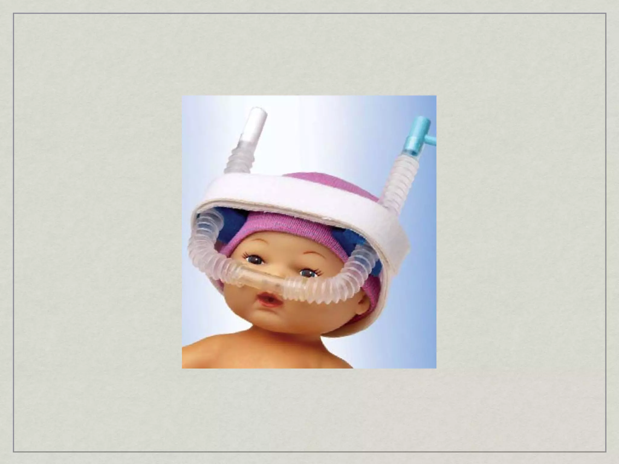 SCBU CPAP DR STEVE WONG | PPT