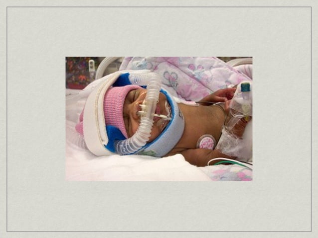 SCBU CPAP DR STEVE WONG | PPT