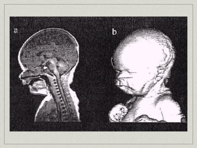 SCBU CPAP DR STEVE WONG | PPT