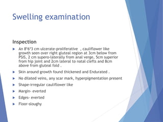 SQUMOUS CELL CARCINOMA | PPT