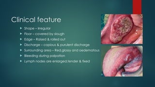 Squamous Cell Carcinoma of Oral Cavity By Dr. Jahid Hasan Jamil | PPTX