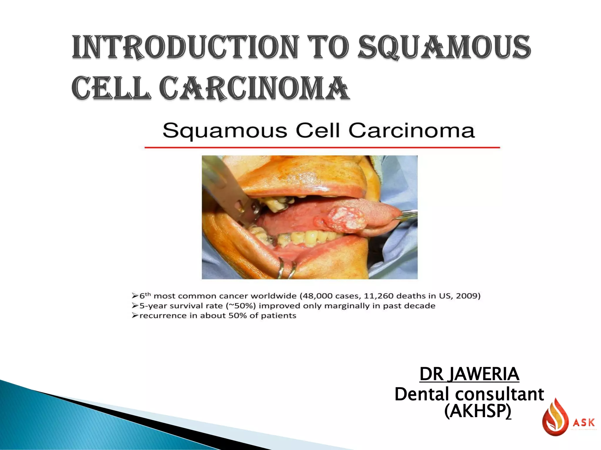 "Oral Squamous Cell Carcinoma" | PDF