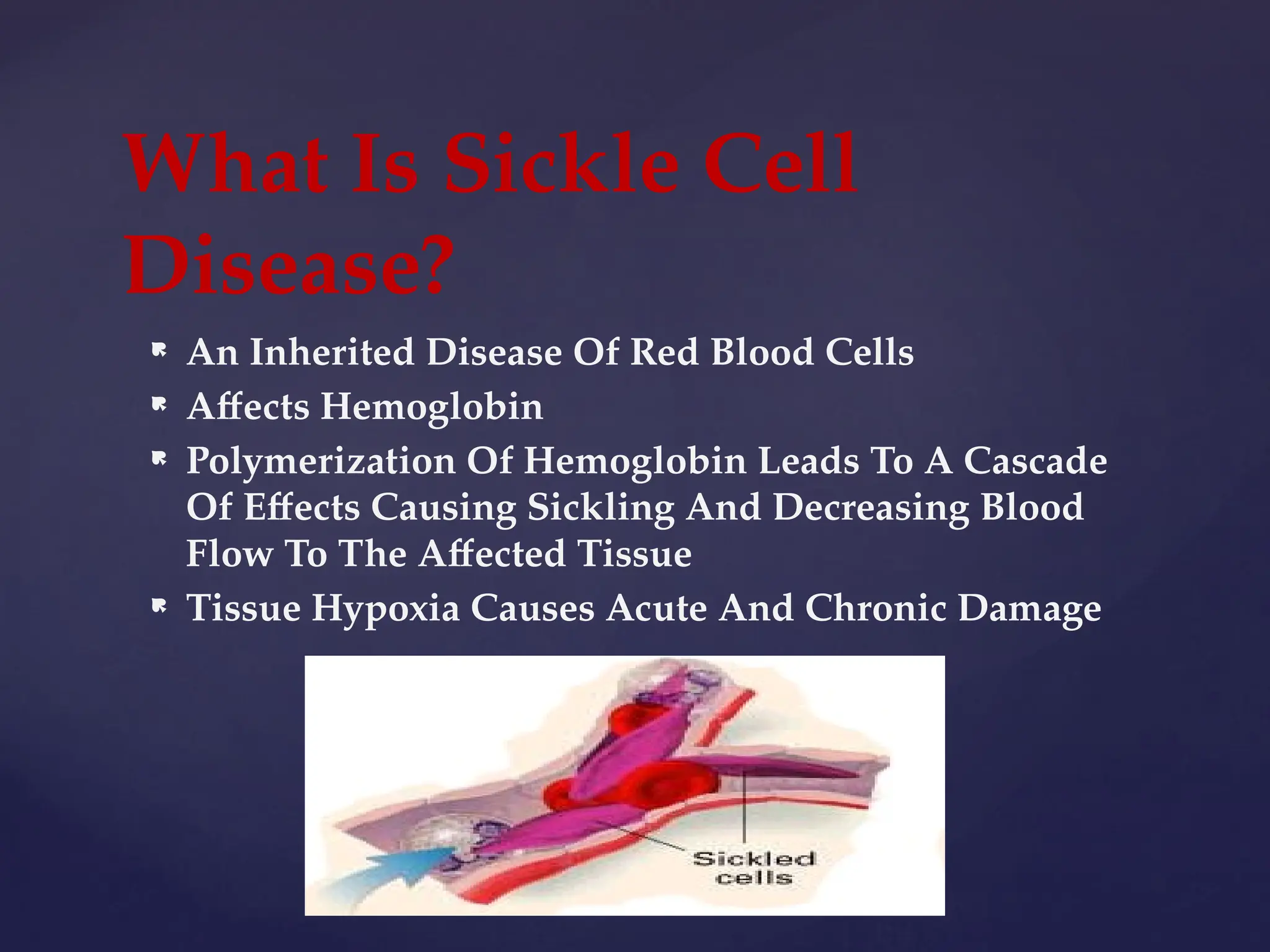 sickle cell disease and its complications | PPTX