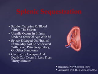 sickle cell disease management and complications | PPTX