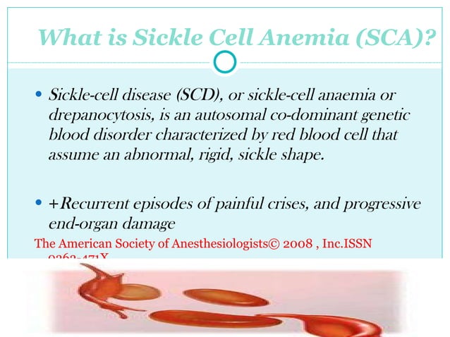 Sickle Cell Disease Ppt