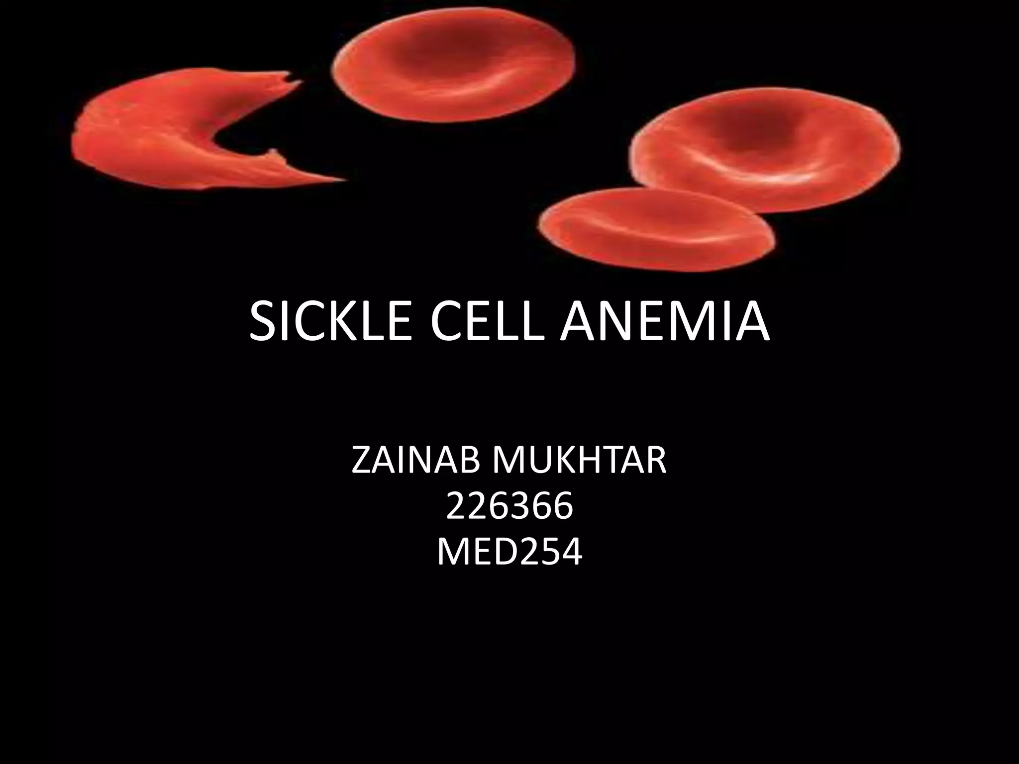 Sickle Cell Disease Ppt