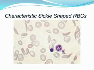 Sickle Cell Disease and ICU | PPSX