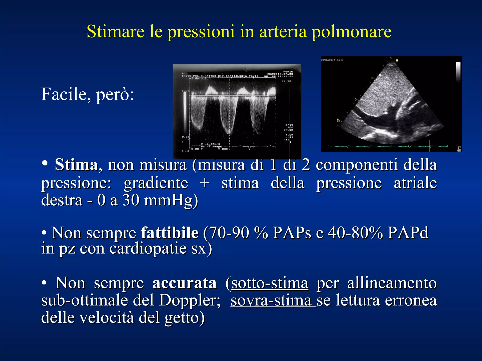 Imaging con Ecocardiogramma | PPT