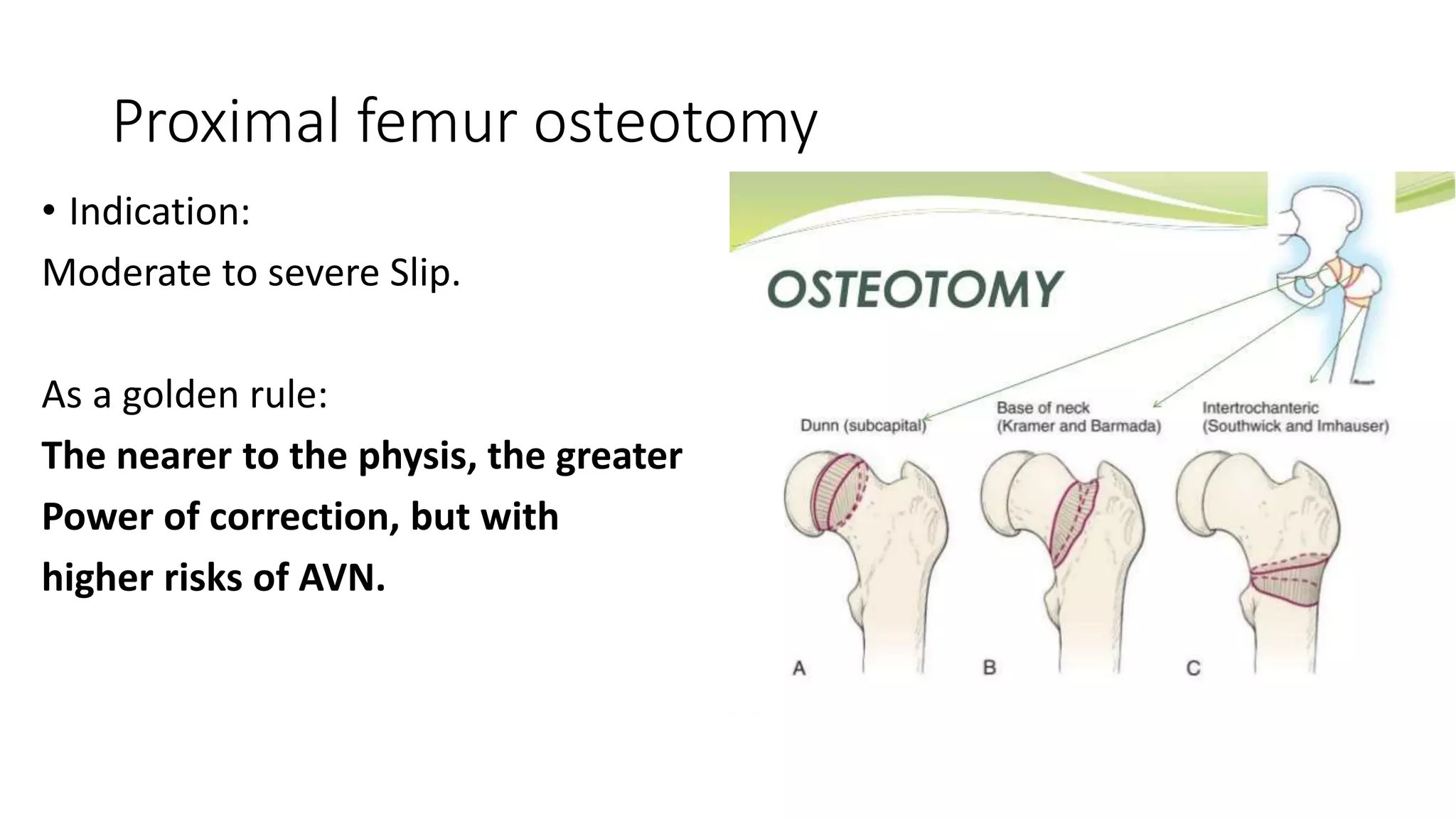 Slipped Capital Femoral Epiphysis | PPTX